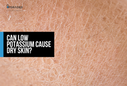 Can Low Potassium Cause Dry Skin? - Upgraded Formulas®