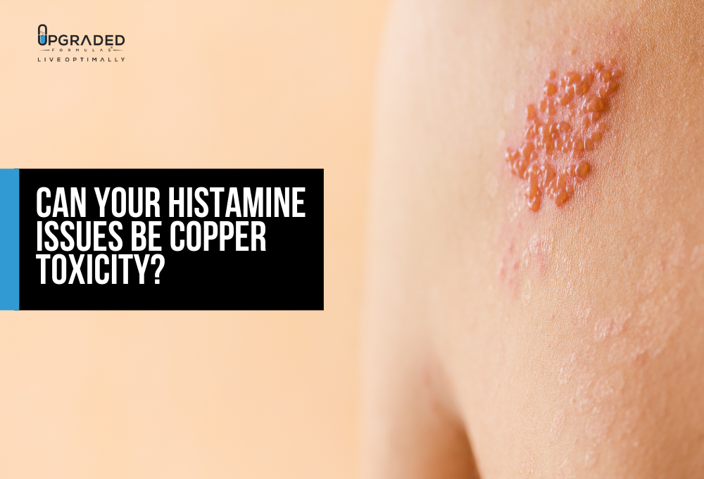 Can Your Histamine Issues Be Copper Toxicity? - Upgraded Formulas®