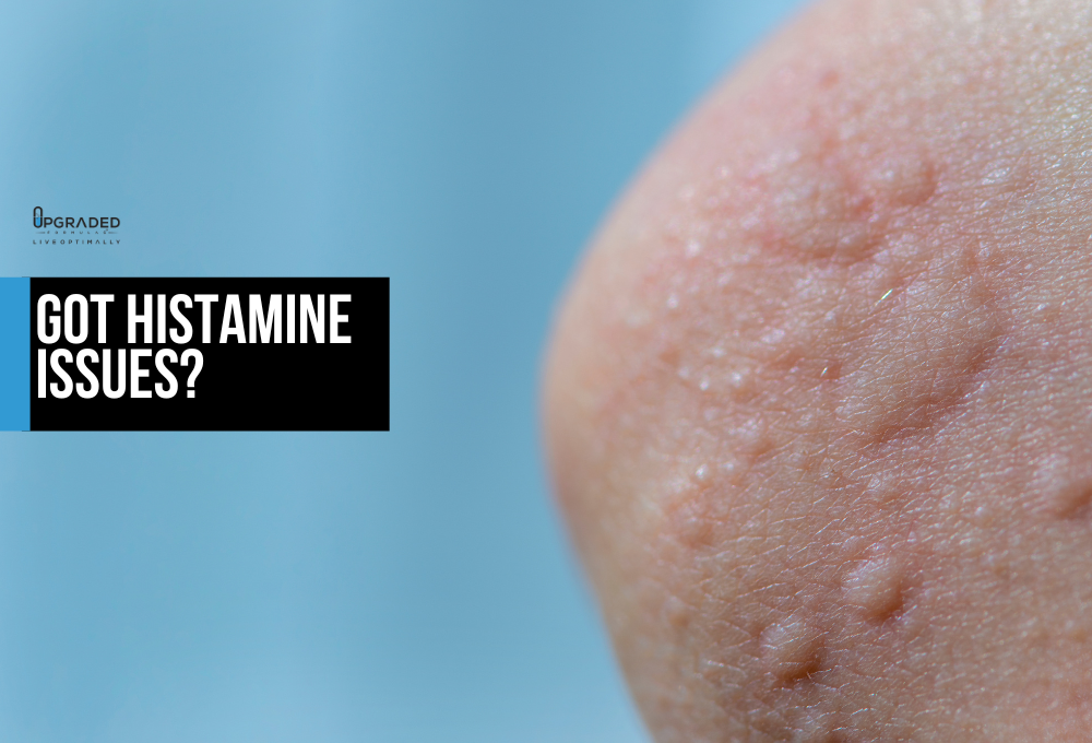 Histamine Issues and Copper Dysregulation - Upgraded Formulas®