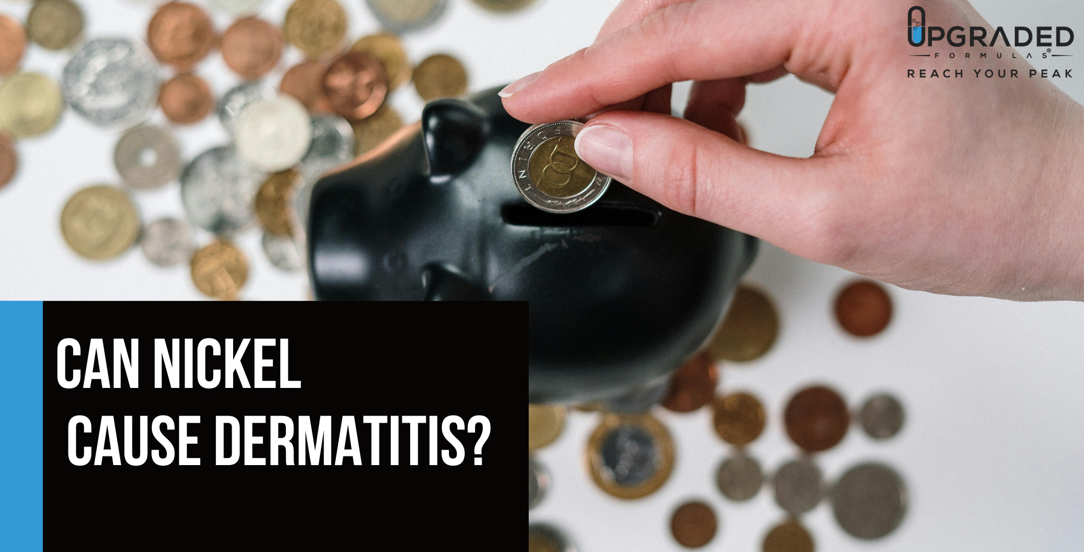 Can Nickel Cause Dermatitis? - Upgraded Formulas®