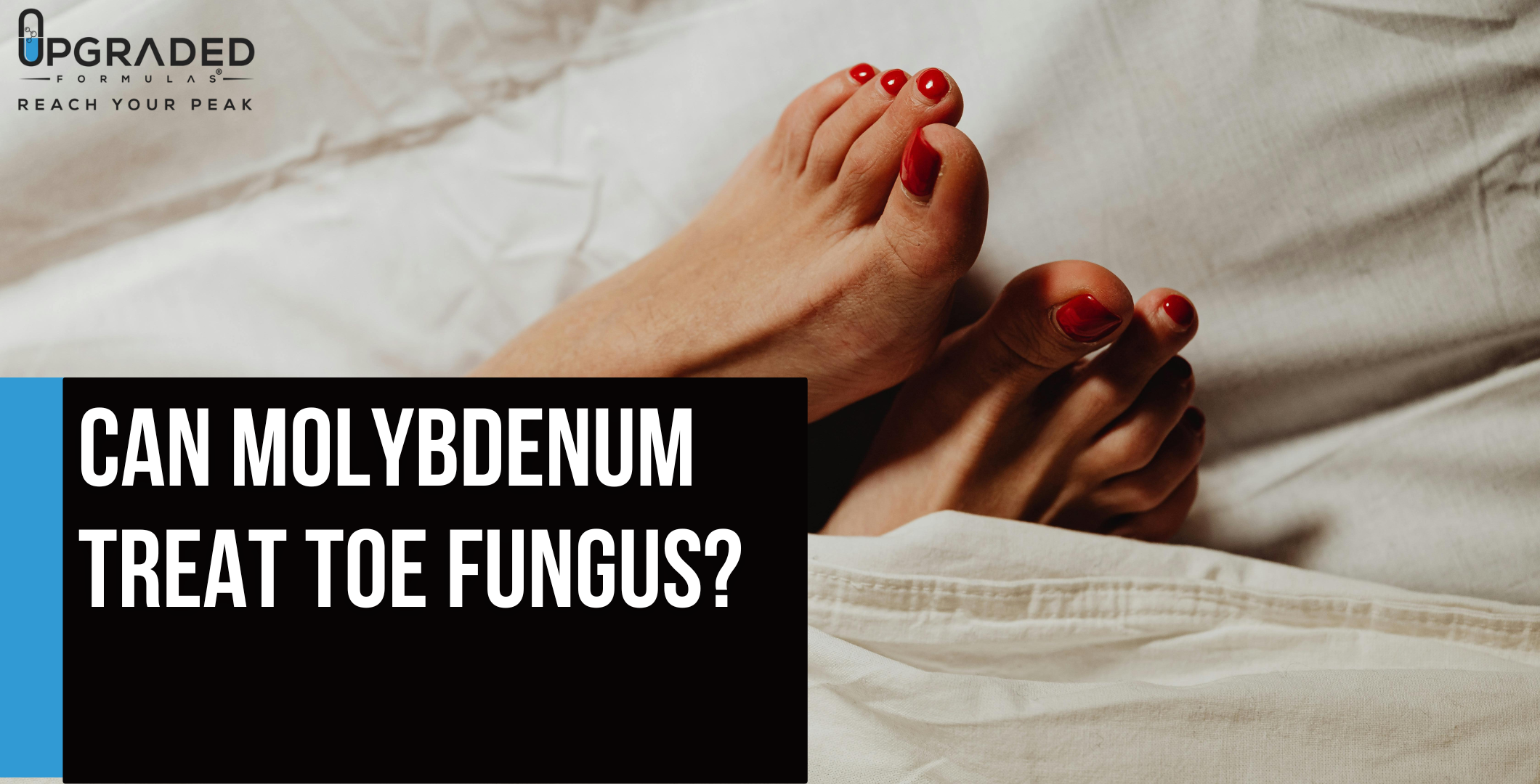 Can Molybdenum Treat Toe Fungus? - Upgraded Formulas®